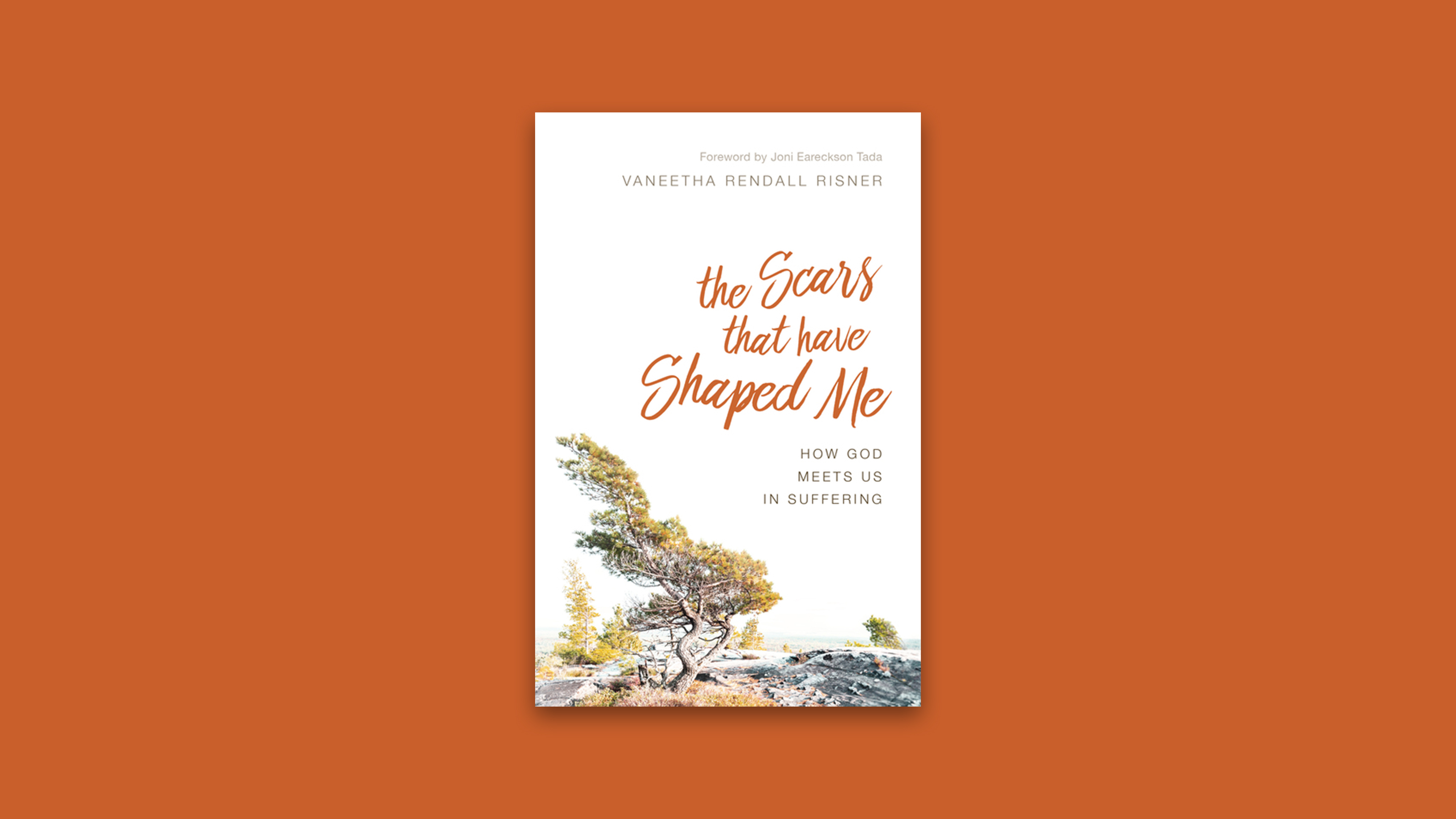 The Scars That Have Shaped Me: How God Meets Us in Suffering | Desiring God